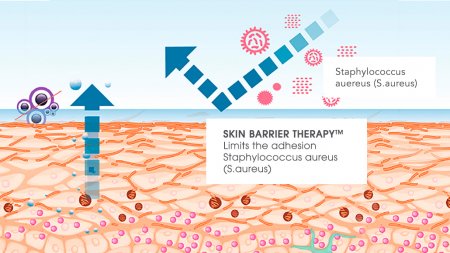 About Skin Barrier Therapy | BIODERMA